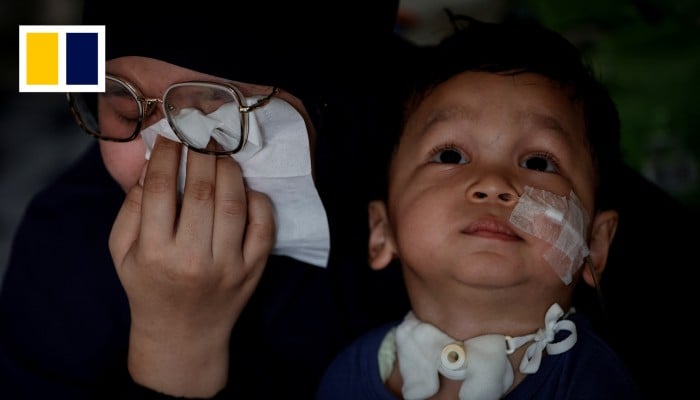 Toxic cough syrup victims forced to confront devastating effects every ...