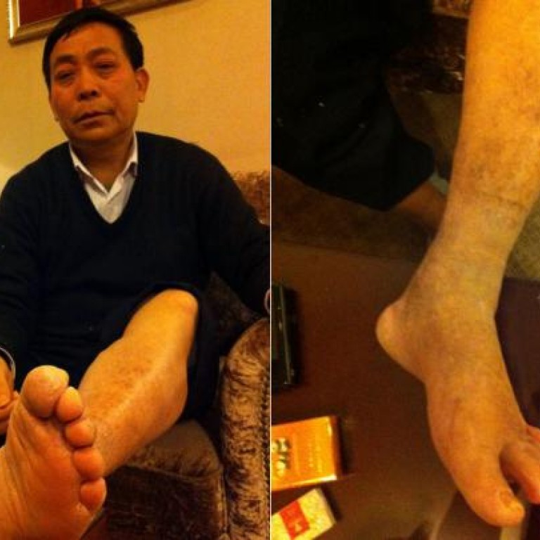 Trying to escape Bo Xilai's shadow: How victims still bear scars ...