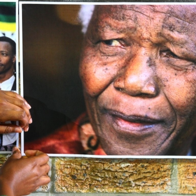 Nelson Mandela Still Critical But Much Better Zuma Says South