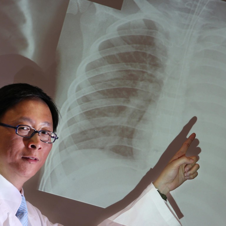 Drug-resistant bacterium a danger to young patients | South China ...