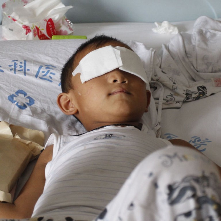 Boy's eyes gouged out by his aunt, police say | South China Morning Post