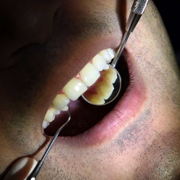 Mussel ‘glue’ could stop sensitivity in teeth | South China Morning Post