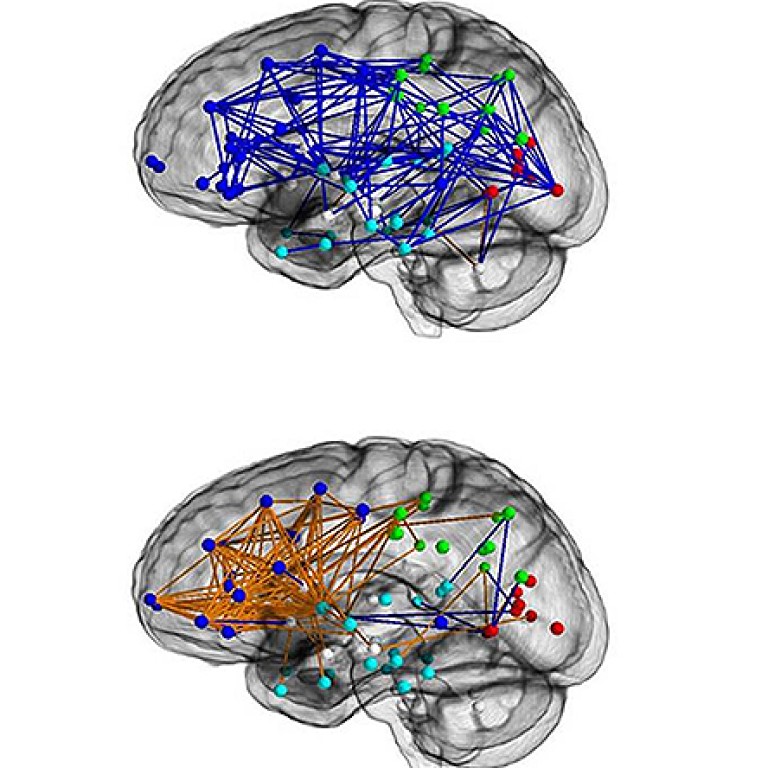 Brain maps confirm stereotypes about men and women, says scientists ...