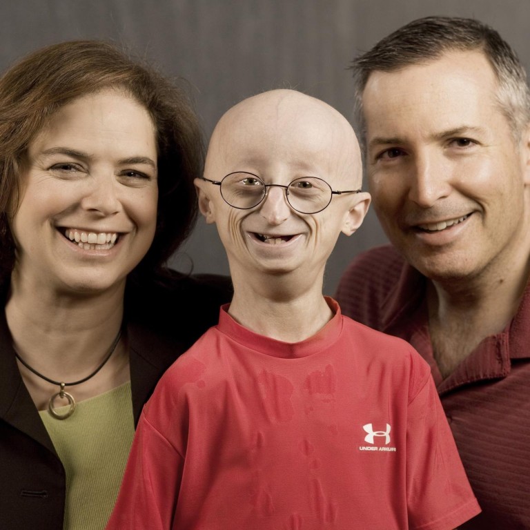 Sam Berns, subject of HBO film on rare ageing condition, dies at 17 ...