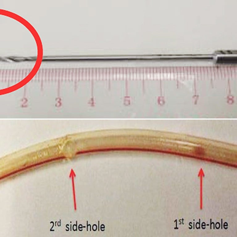 Number of surgical objects left in bodies of Hong Kong patients hits ...