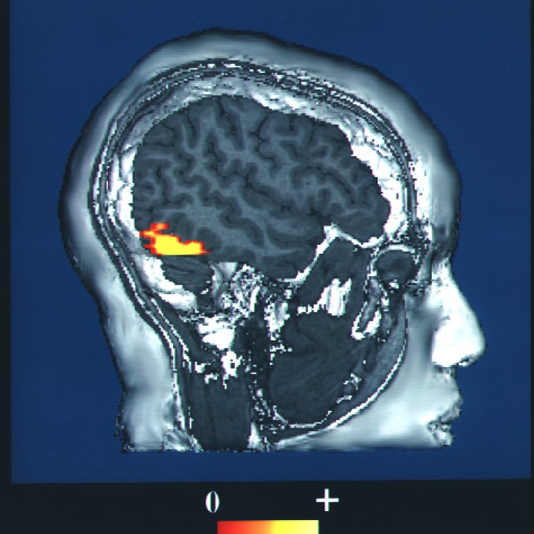Neuroscientists are just beginning to understand the human brain's ...
