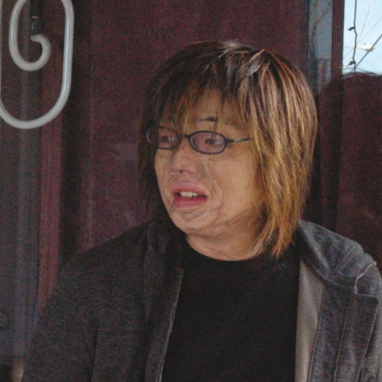 Pat Sin Leng Hill Fire Survivor Stanley Cheung Yun-Hang | South China ...