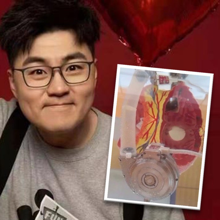 Chinese man with no natural heartbeat now a popular stand-up comedian 3 ...