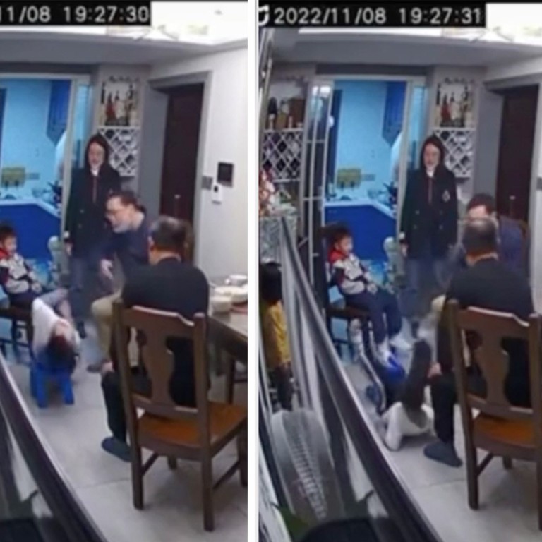 Swollen, bruised face for boy, 5, after alleged slap from Chinese ...