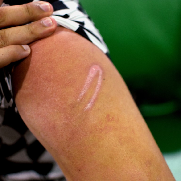 Exclusive | Survivors of Myanmar’s scam mills talk torture, death – and ...