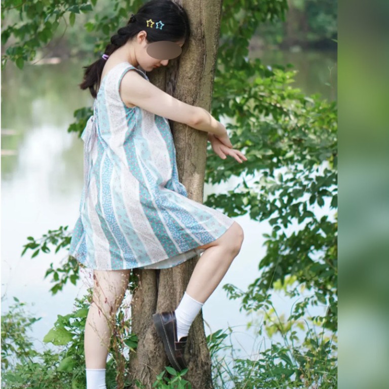 ‘New kind of psychological massage’: tree-hugging craze spreads across ...