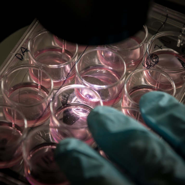 Scientists create human embryo models without sperm or egg | South ...