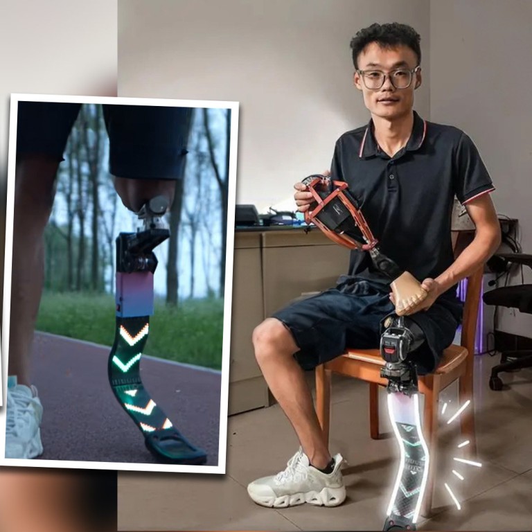 ‘I control my life’: China amputee with blinking prosthetic leg ...