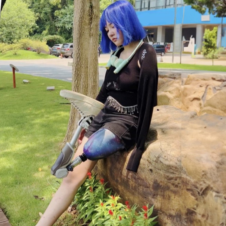 ‘I’m out of your league’: woman in China who lost limbs in car crash ...