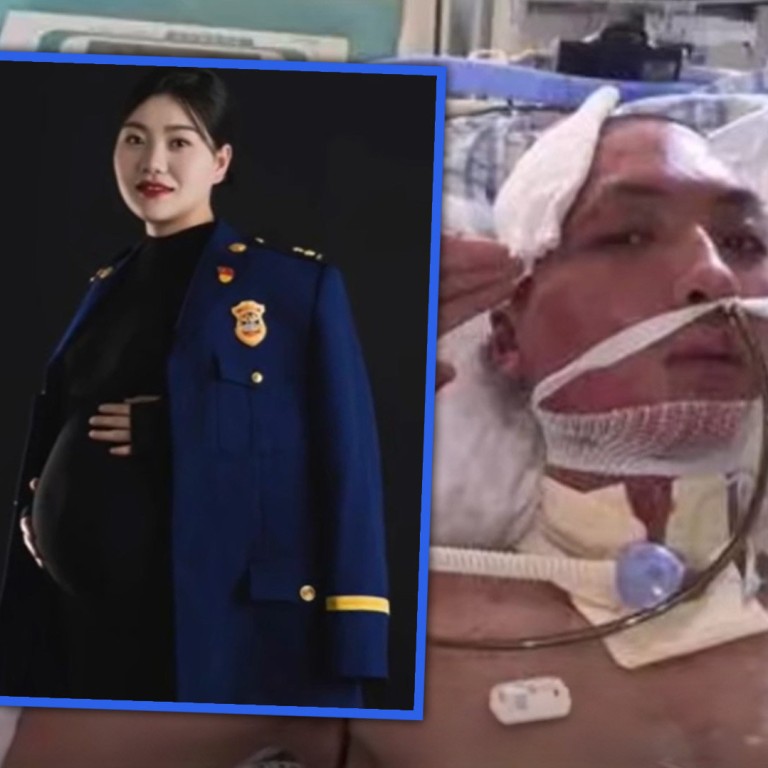 ‘He loves us most’: girlfriend of brave firefighter with 90% burns and ...