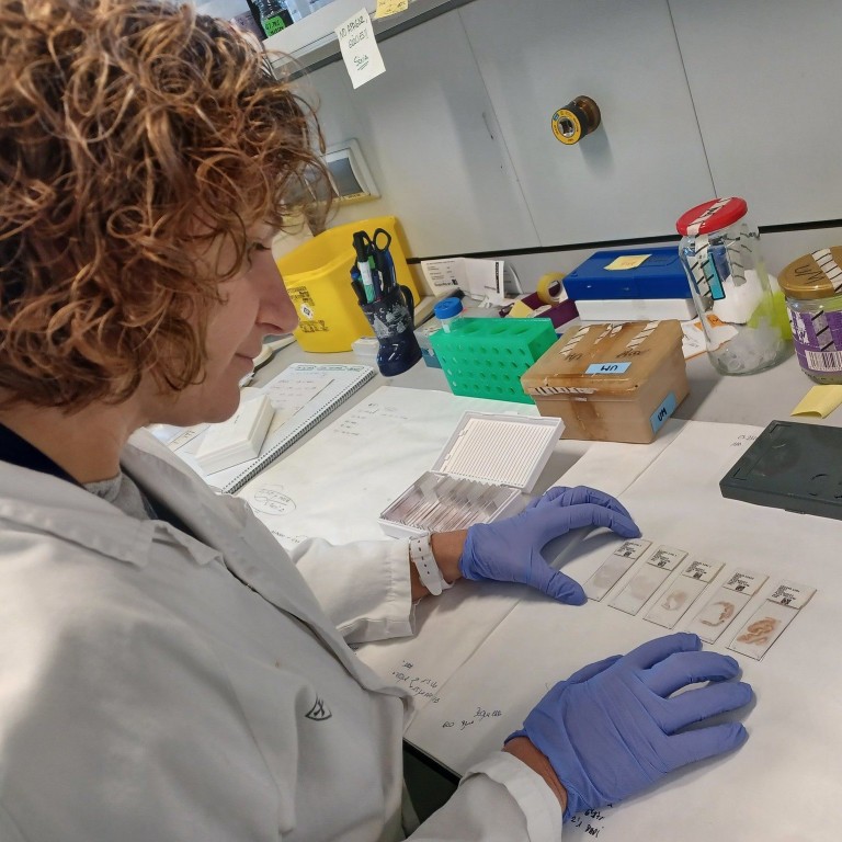 Dementia study links genes inherited from parents to development of ...
