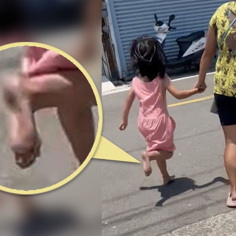 ‘Cruel’ Taiwan mother panned for making daughter, 6, walk barefoot on ...