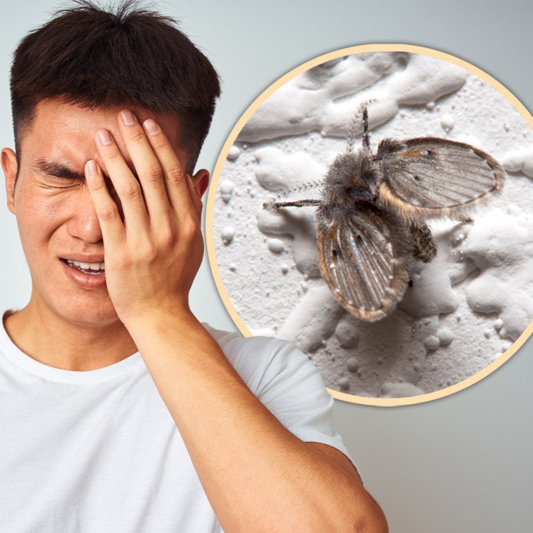 Fly-swatting man in China loses eye after killing pesky insect that ...