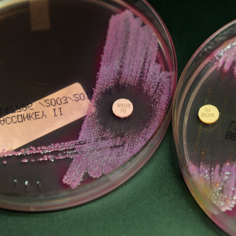 Microbes 1, Humans 0: scientists spy on superbugs to see how they ...