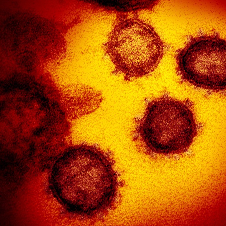 Leprosy drug clofazimine effective in suppressing Covid-19, researchers ... Leprosy drug clofazimine effective in suppressing Covid-19, researchers ...