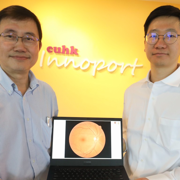 Mapping the mind: Chinese and French scientists advance on neural ...