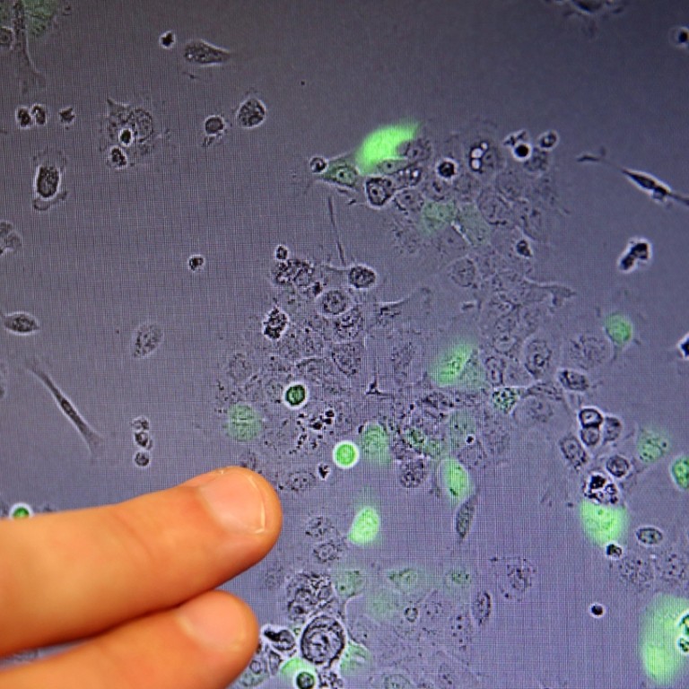 Alarming new ‘superbug’ gene resistant to last-resort antibiotics found ...