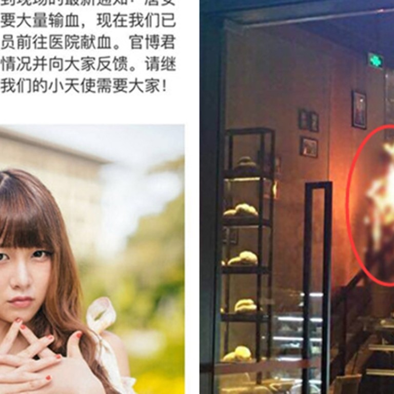 Tanq Anqi, member of Shanghai girl idol band, suffers severe burns ...