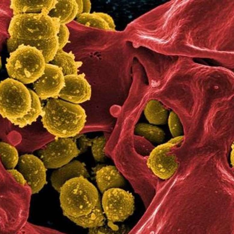 Does ‘Trojan Horse’ chemical compound DHBP spell doom for world’s ...