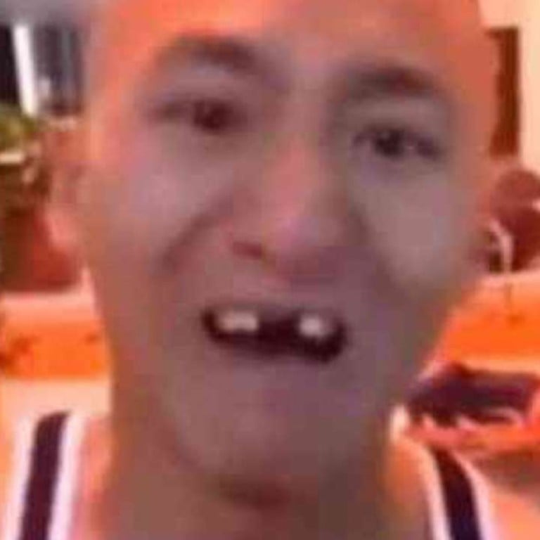 Chinese man loses two front teeth trying to eat raw corn on the cob off ...