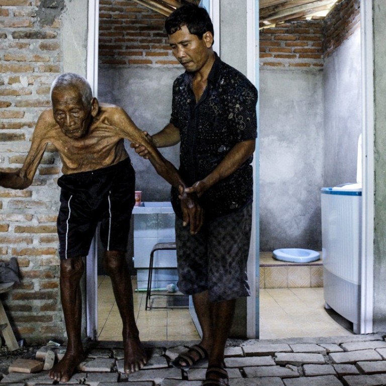 Family claims Indonesian man lived to 146. Here’s what science says ...