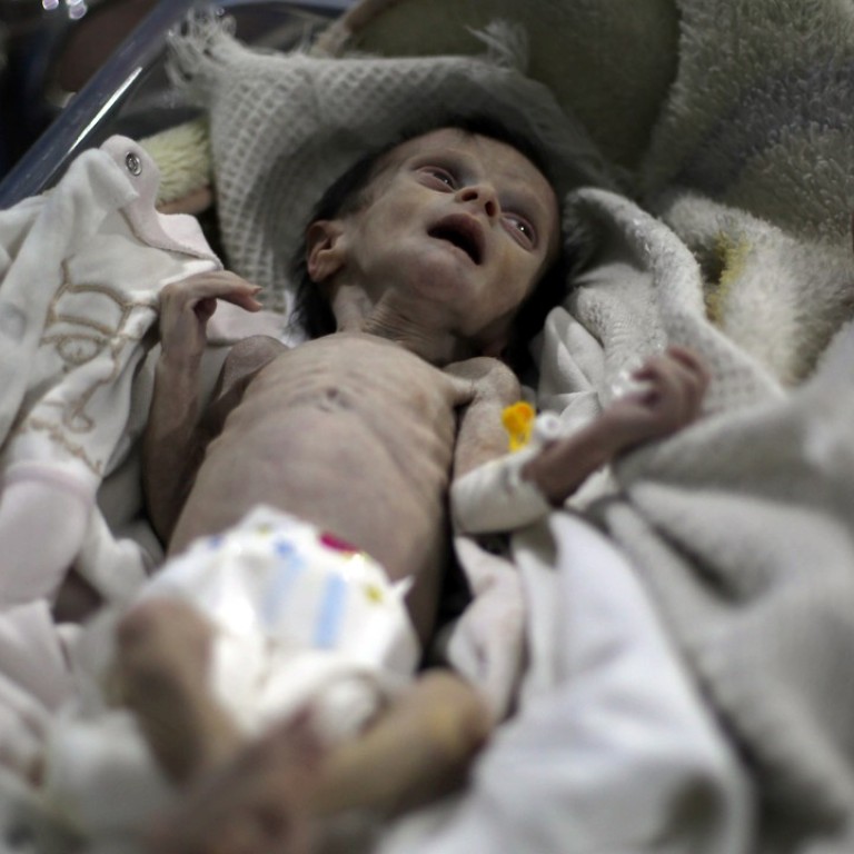 Heartbreaking images of starving Syrian baby Sahar, close to death ...