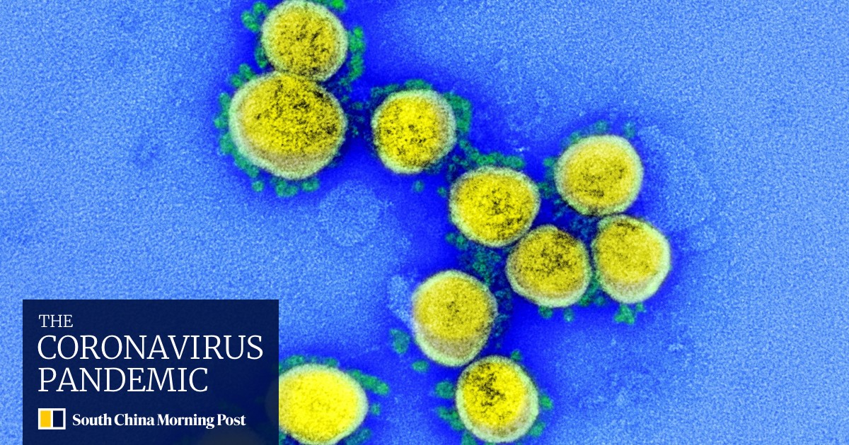 Synthetic coronavirus created with brewer’s yeast comes with research ...