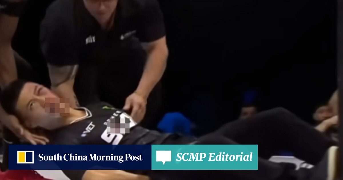 broken eye socket slap competition