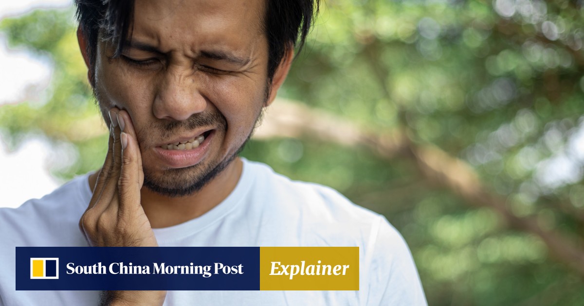Explainer | On World Toothache Day, experts outline why your teeth hurt ...