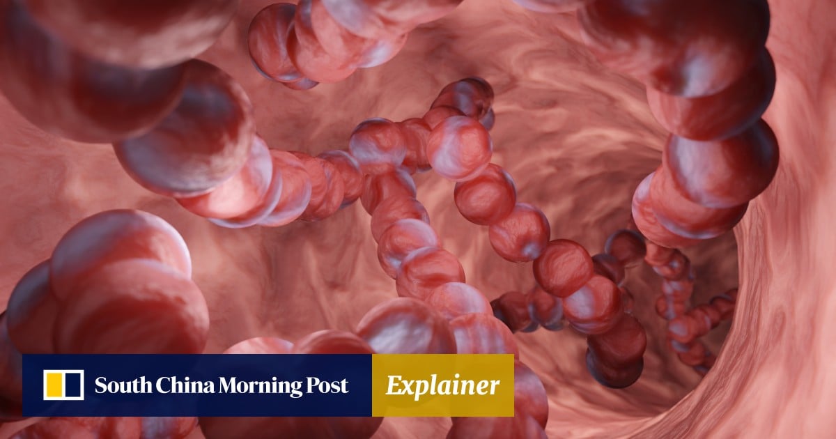 Explainer Strep Throat All You Need To Know About The Contagious explainer-strep-throat-all-you-need-to-know-about-the-contagious