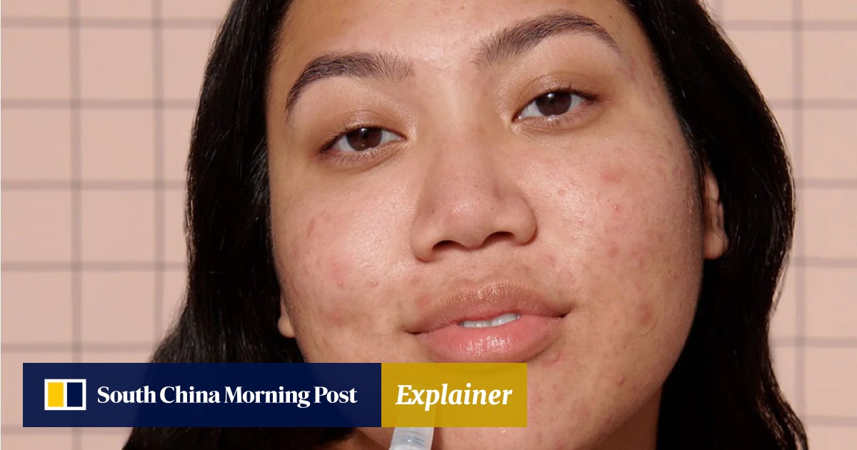 Explainer | What is azelaic acid and how do you use it? The skincare ...