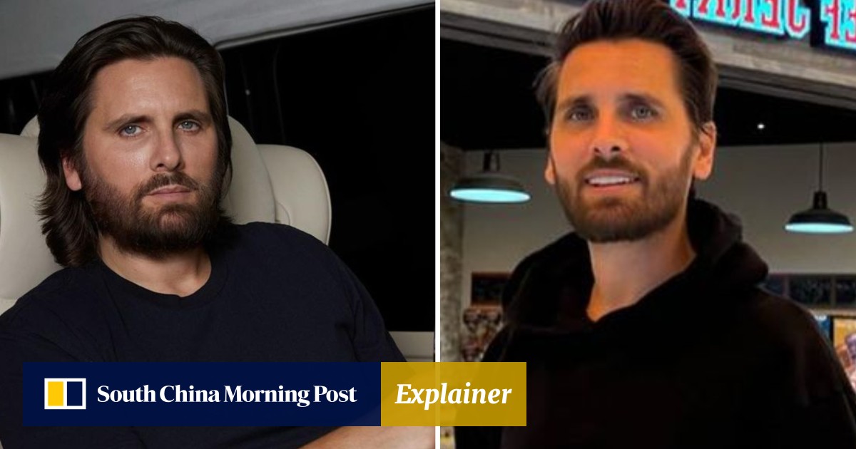 Explainer | What is ‘Ozempic face’ and how can you avoid it? Hollywood ...