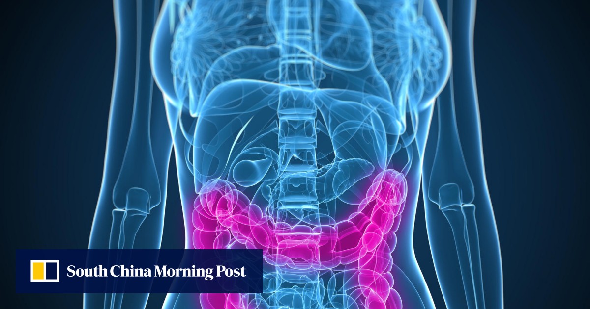 Colonic hydrotherapy has no proven benefits and carries risks | South ...