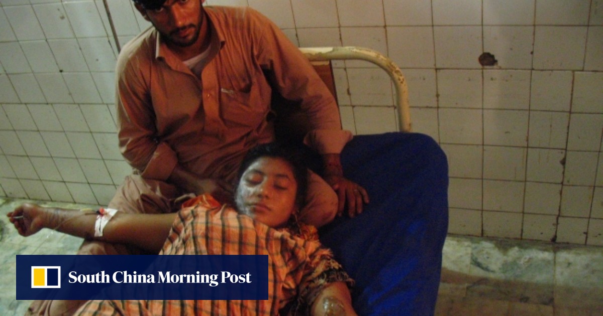 Pakistani actress hit by acid attack | South China Morning Post