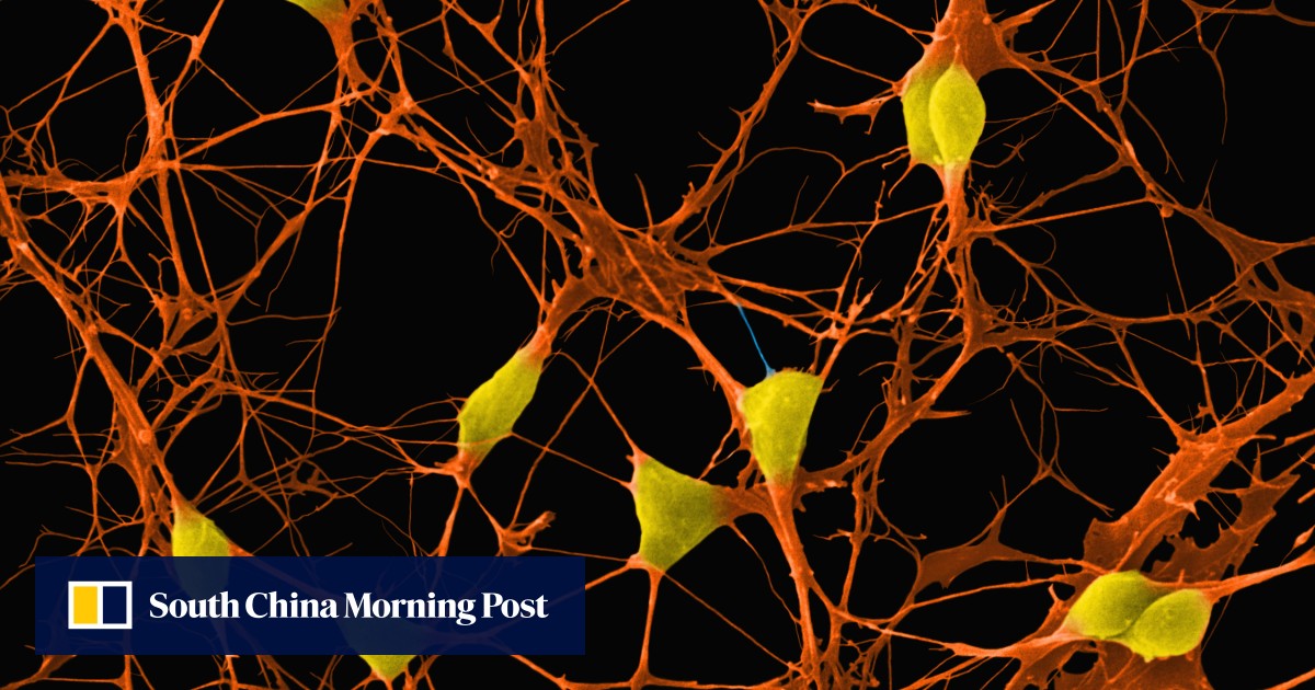 Mapping brains of fruit fly larvae may help build similar 'atlas' for ...