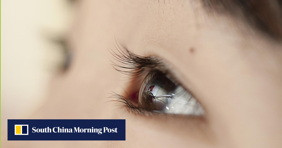 How eye checks can detect disease | South China Morning Post
