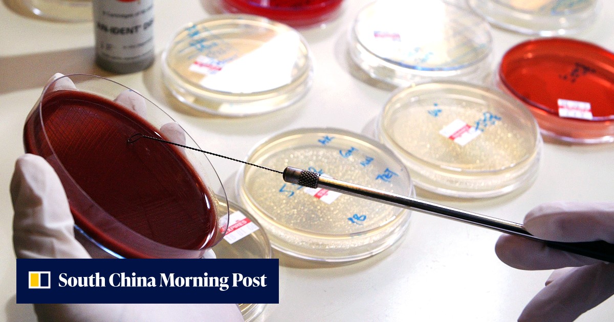 US investigating how deadly bacteria got out of a high-security ...