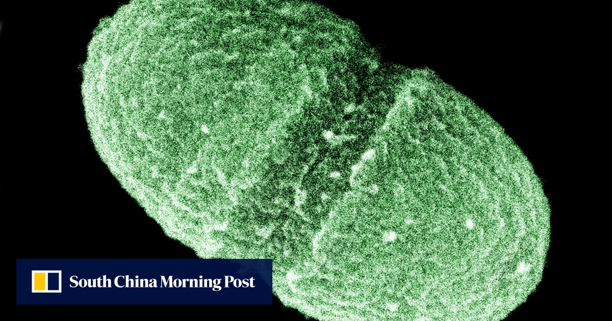 Microbes are the new fingerprint for scientists solving crimes | South ...