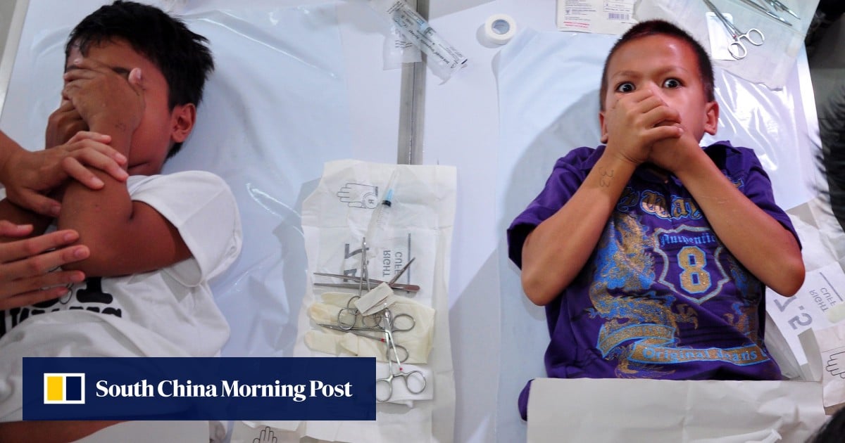 Chinese device cuts surgery time for male circumcisions to 5 mins ...