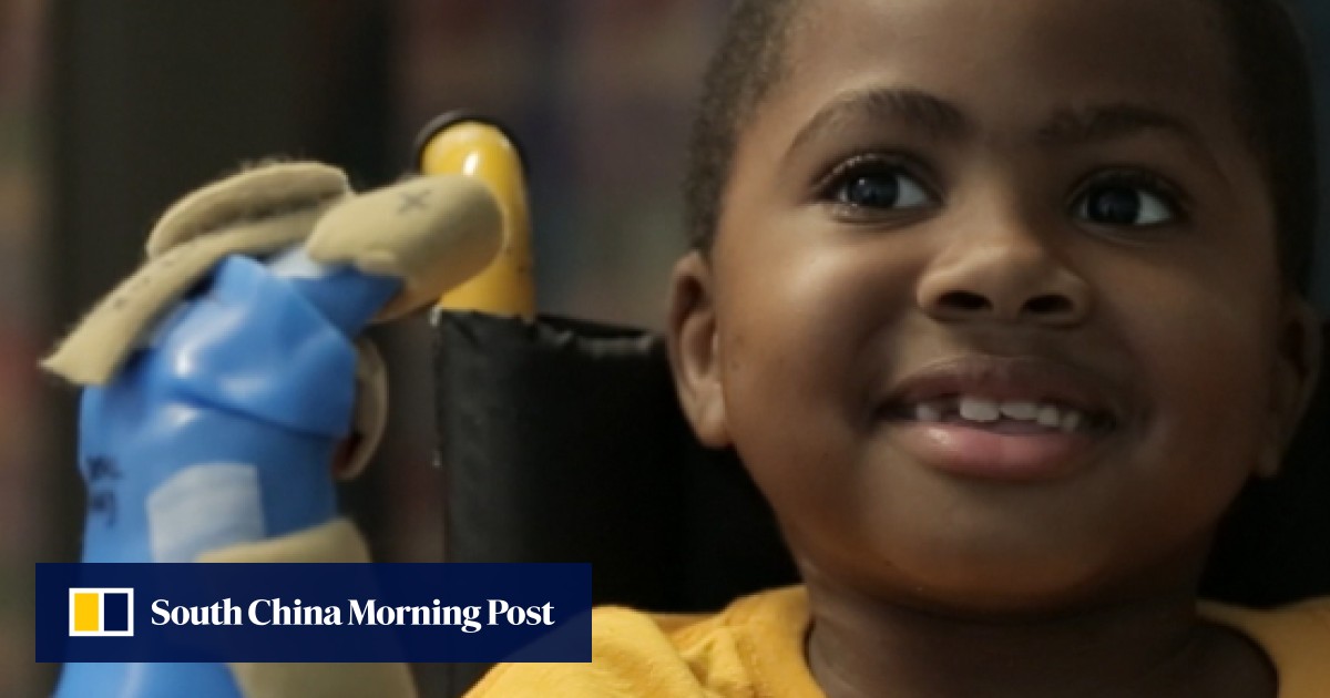 Boy, 8, has world's first child double hand transplant | South China ...