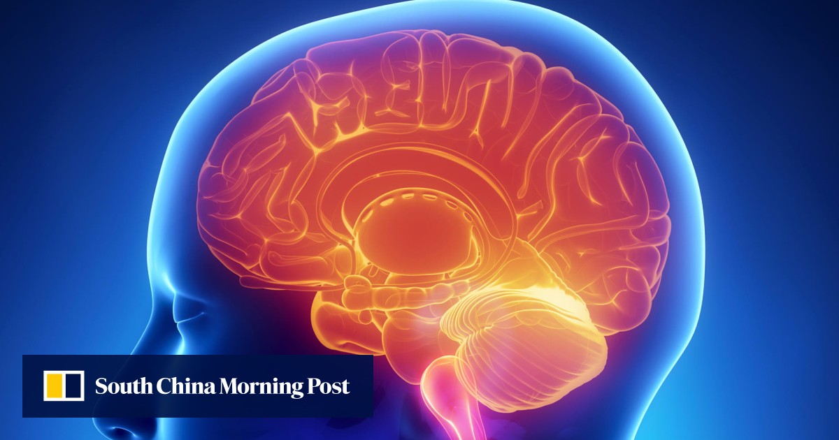 Top 5 futuristic brain-based technologies | South China Morning Post