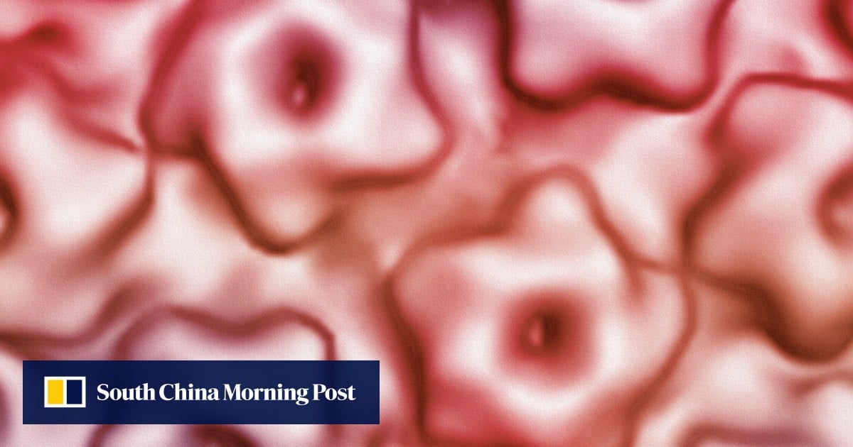 Self-testing urged to cut rate of cervical cancer in Hong Kong | South ...