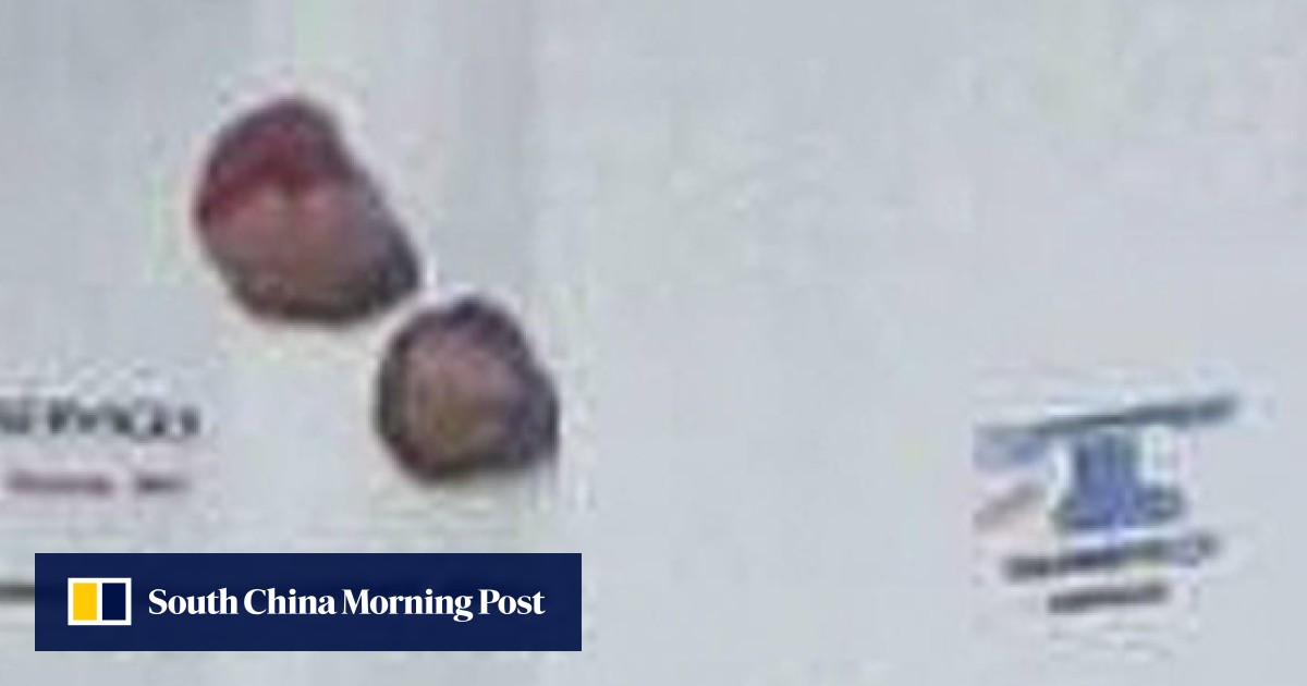 Human teeth found in food served to asylum seeker at Australia's Manus ...