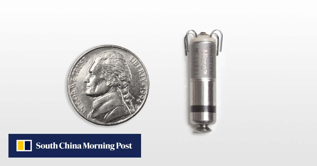 Heart starter: Study hails tiny wireless pacemaker, implanted without ...