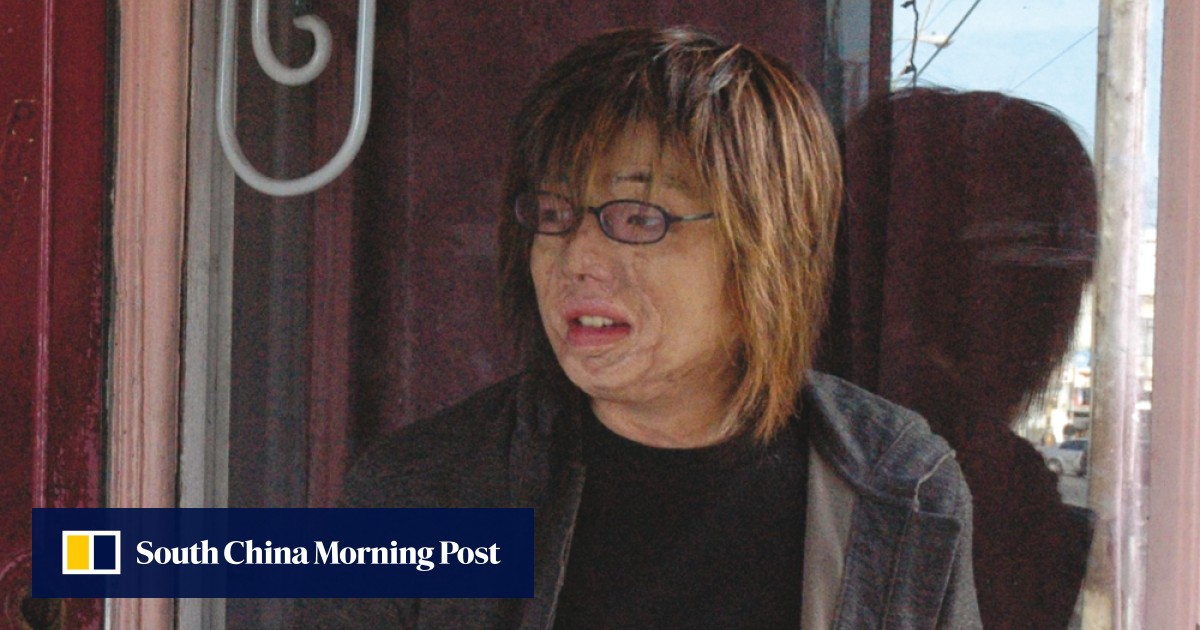 Pat Sin Leng Hill Fire Survivor Stanley Cheung Yun-Hang | South China ...